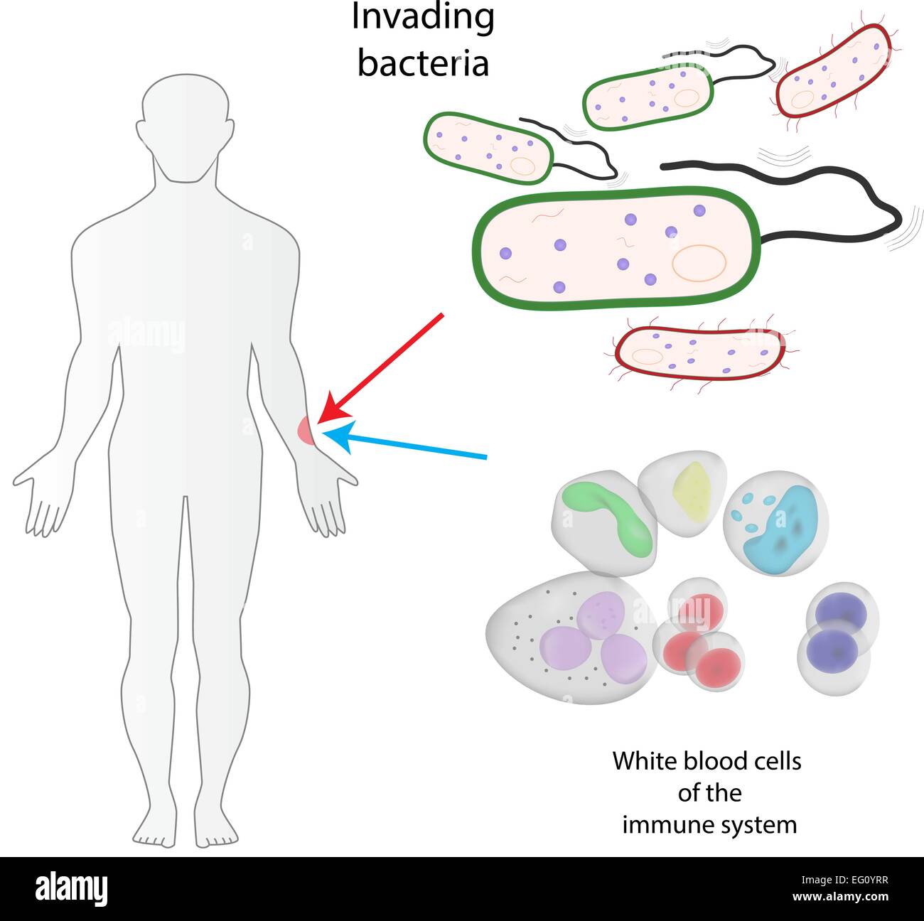 Blood bacteria infection hi-res stock photography and images - Alamy