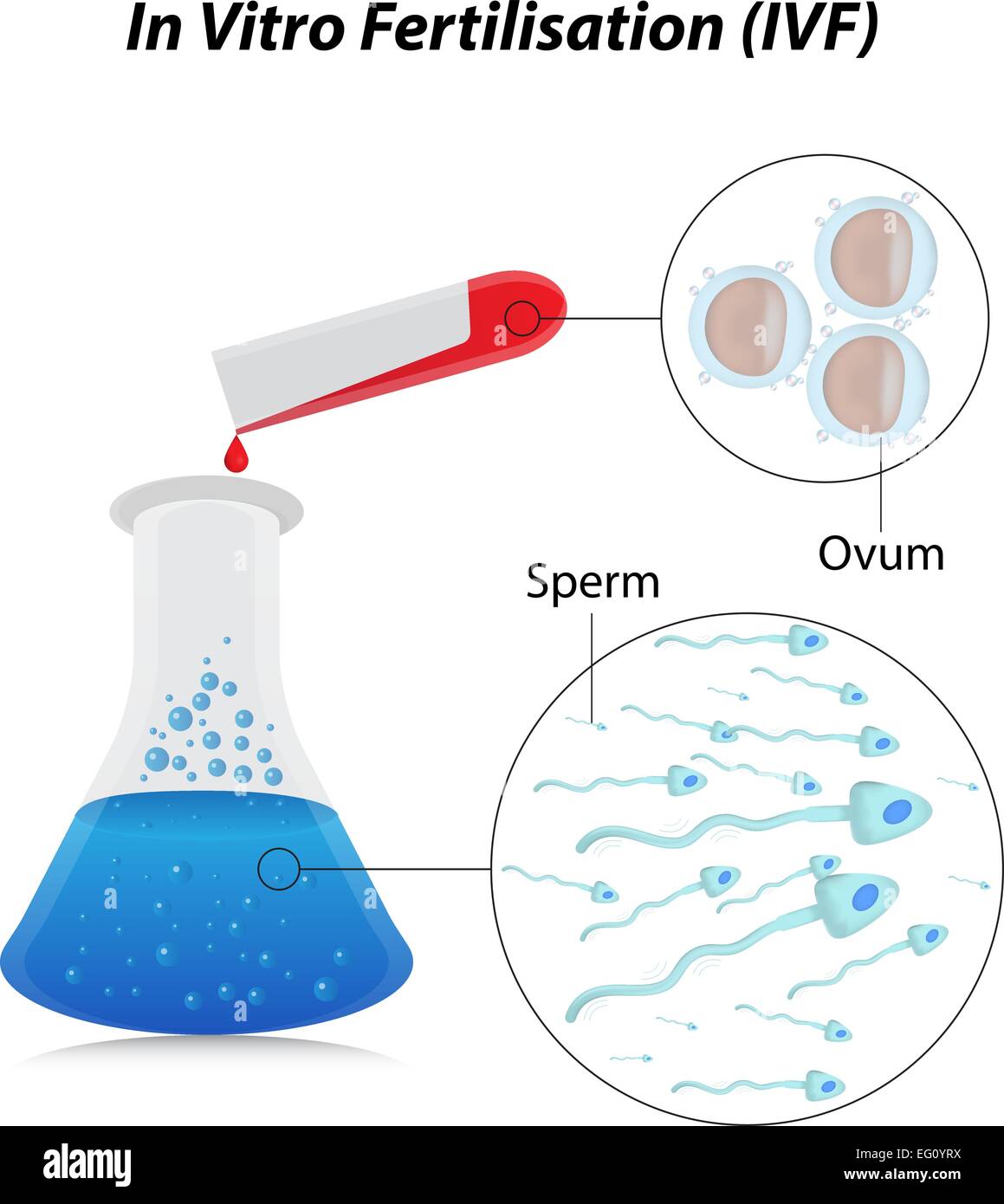 In Vitro Fertilisation IVF Stock Vector Image & Art - Alamy