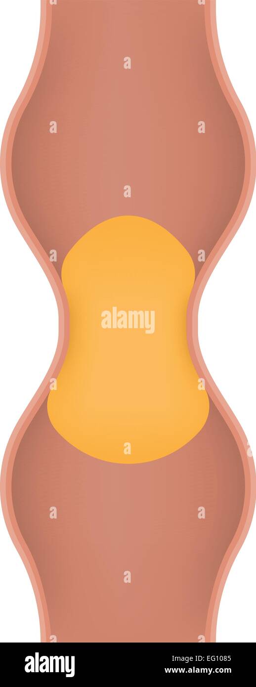 Peristalsis oesophagus Stock Vector Images - Alamy