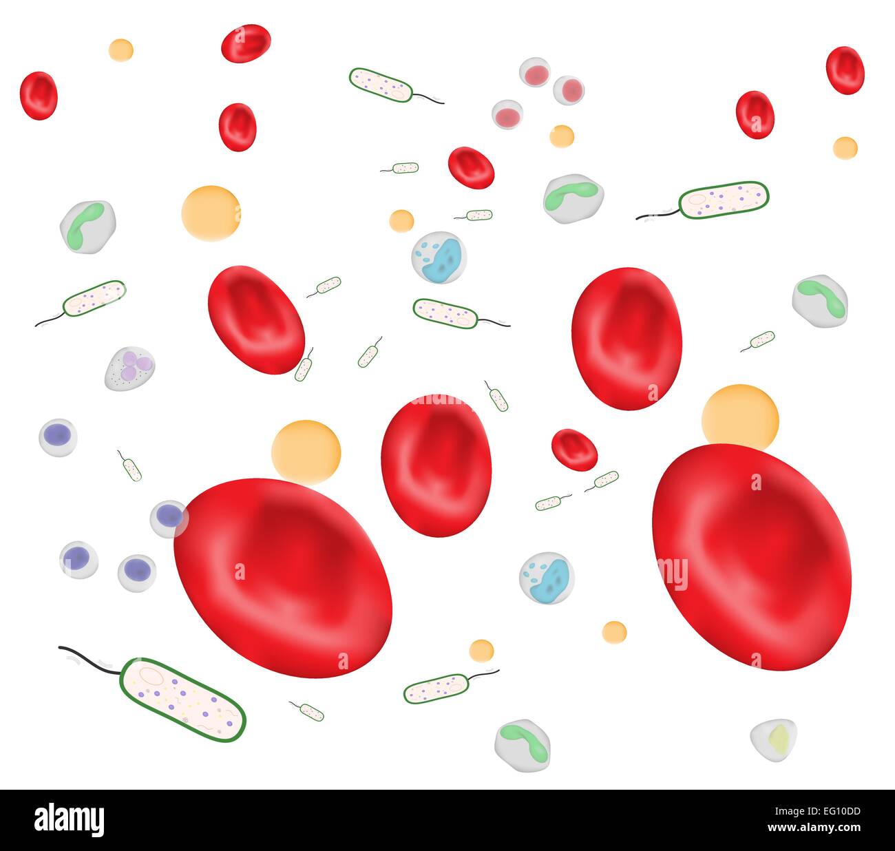 Septicemia hi-res stock photography and images - Alamy