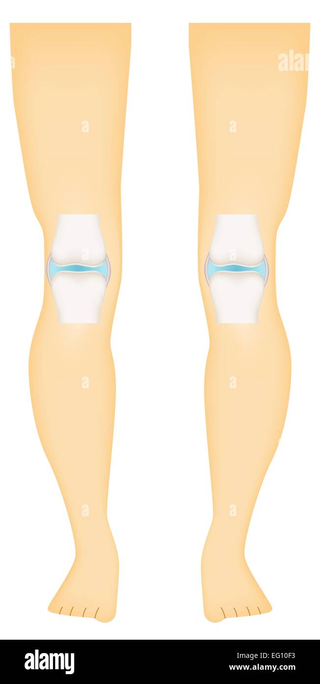 Synovial joint Cut Out Stock Images & Pictures - Alamy
