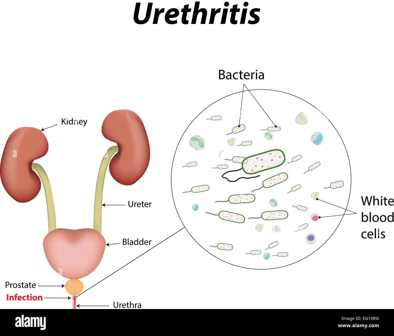 Urinary system hi-res stock photography and images - Alamy