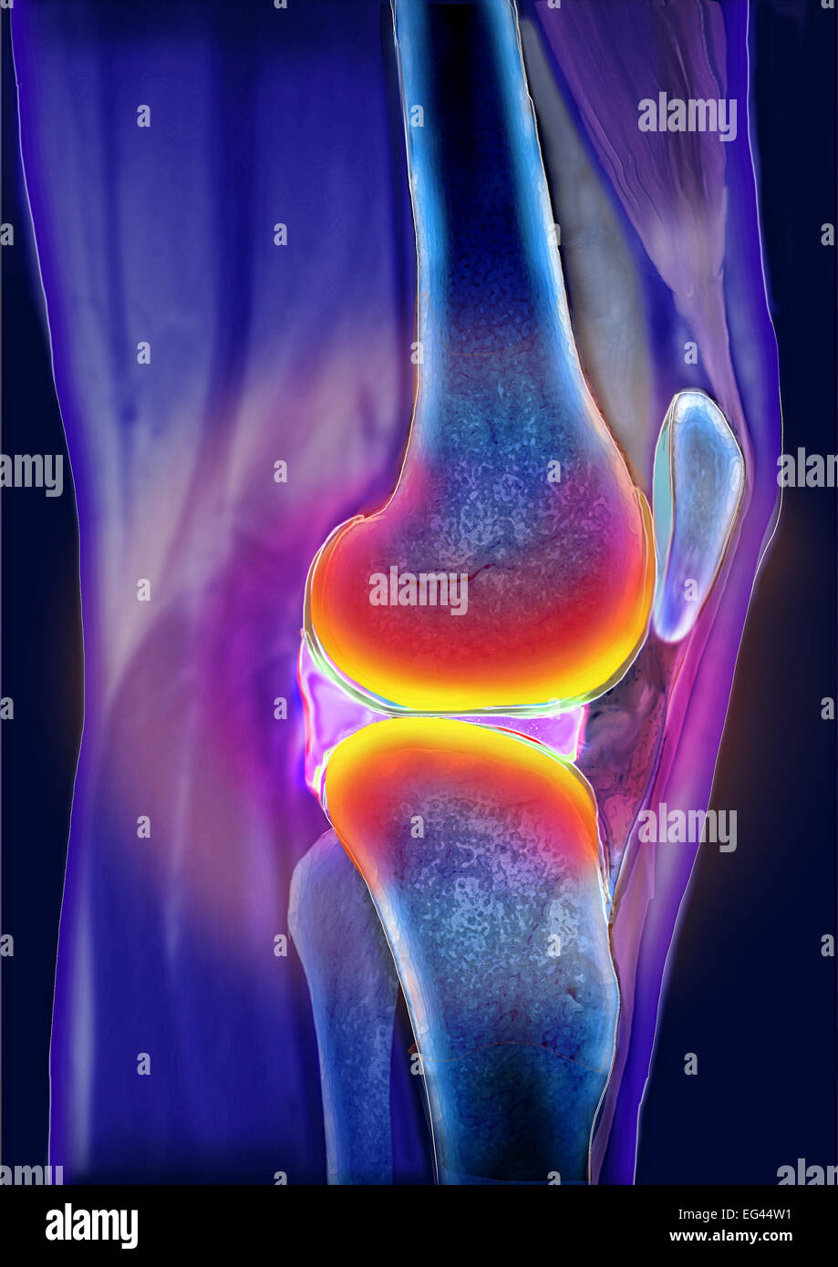 Meniscus hi-res stock photography and images - Alamy