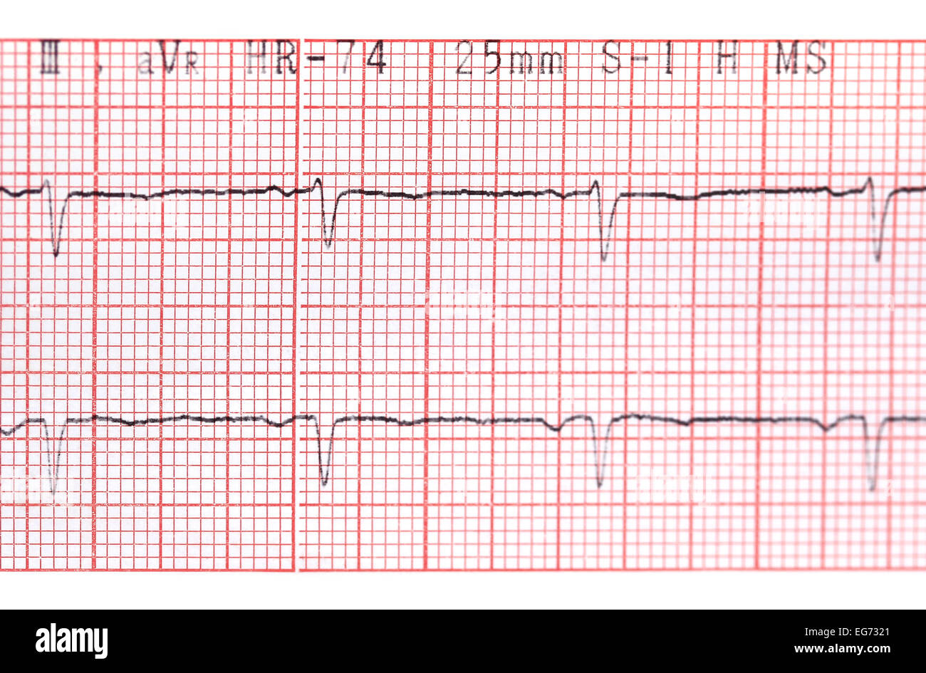 Cardiograph hi-res stock photography and images - Alamy