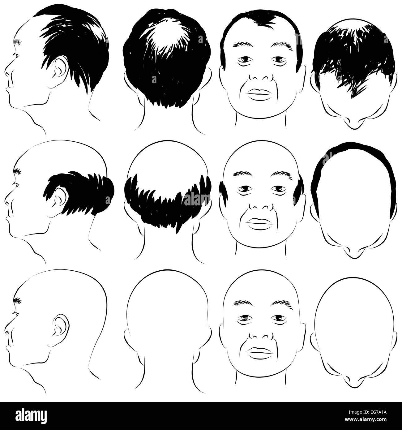 Early Male Pattern Baldness