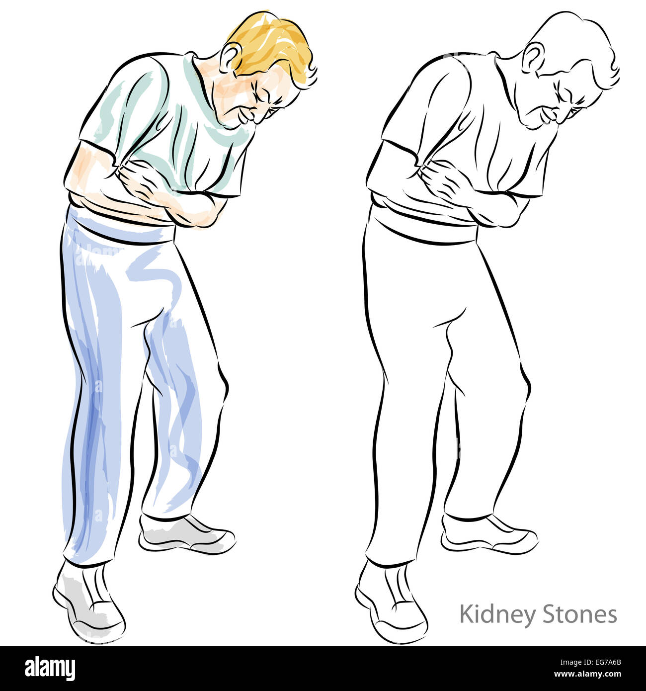Kidney stones medical image hi-res stock photography and images - Alamy