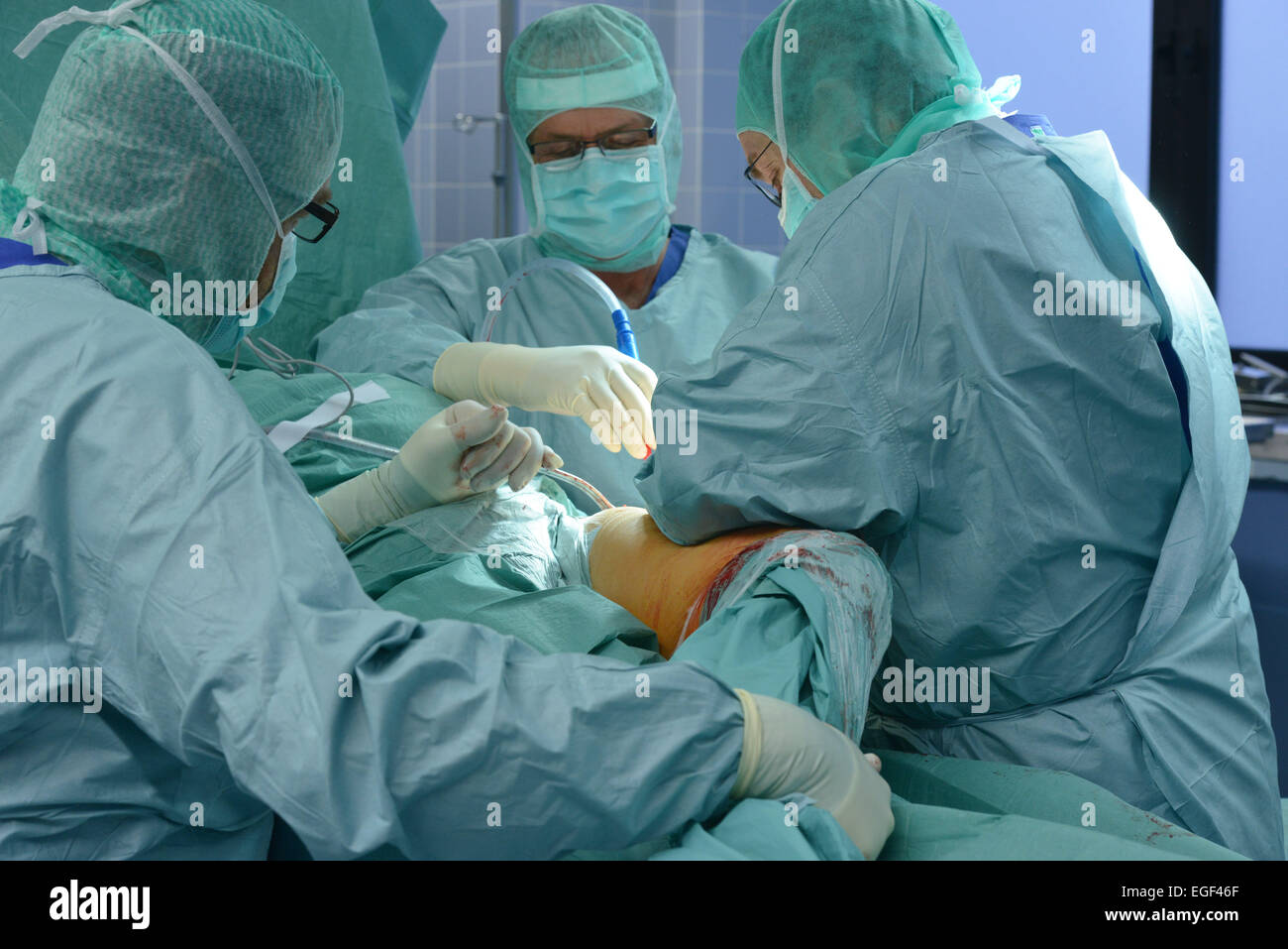 the insertion of an artificial hips belongs today to the standard of ...