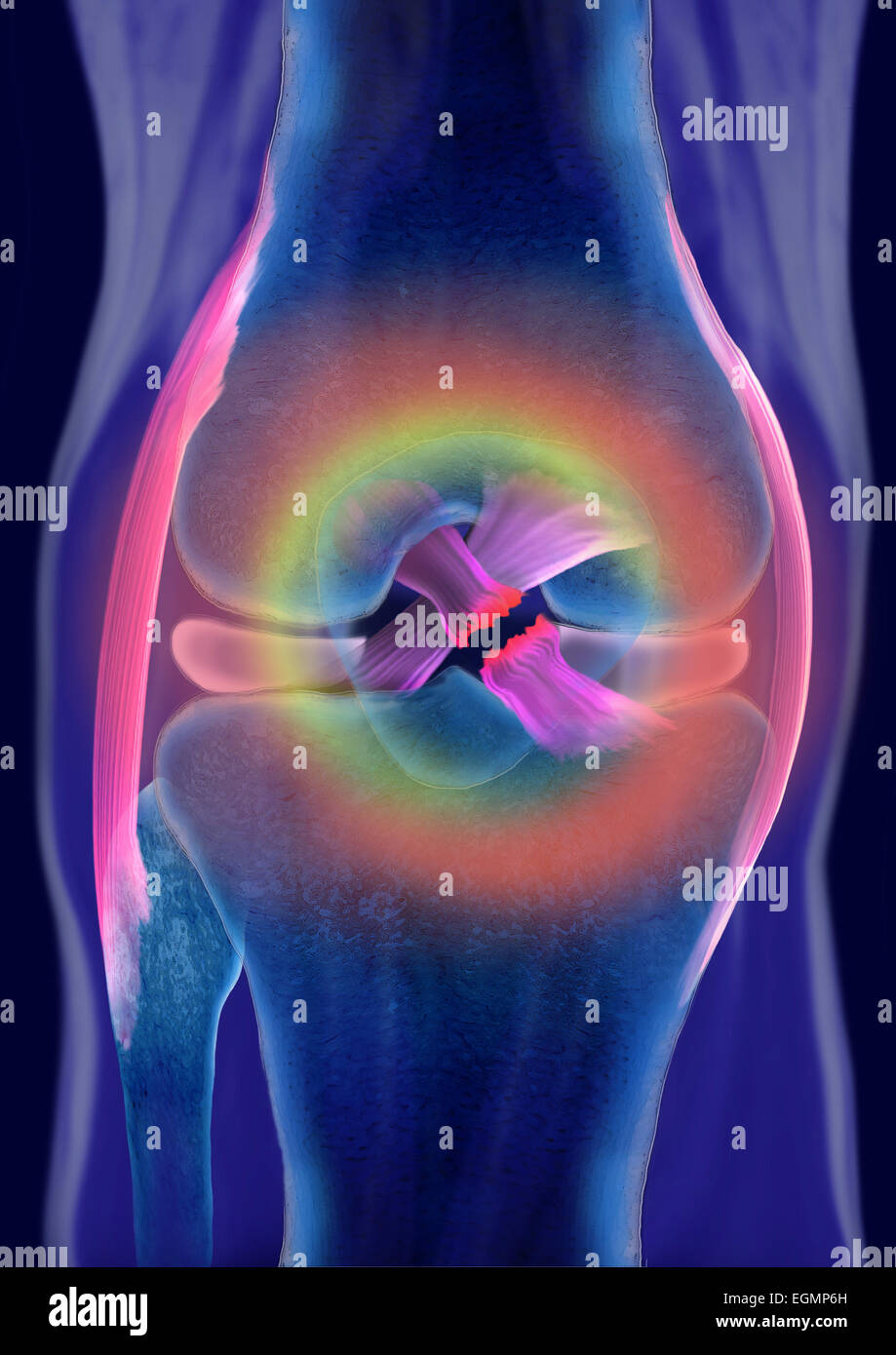 Human cruciate ligament injury hi-res stock photography and images - Alamy