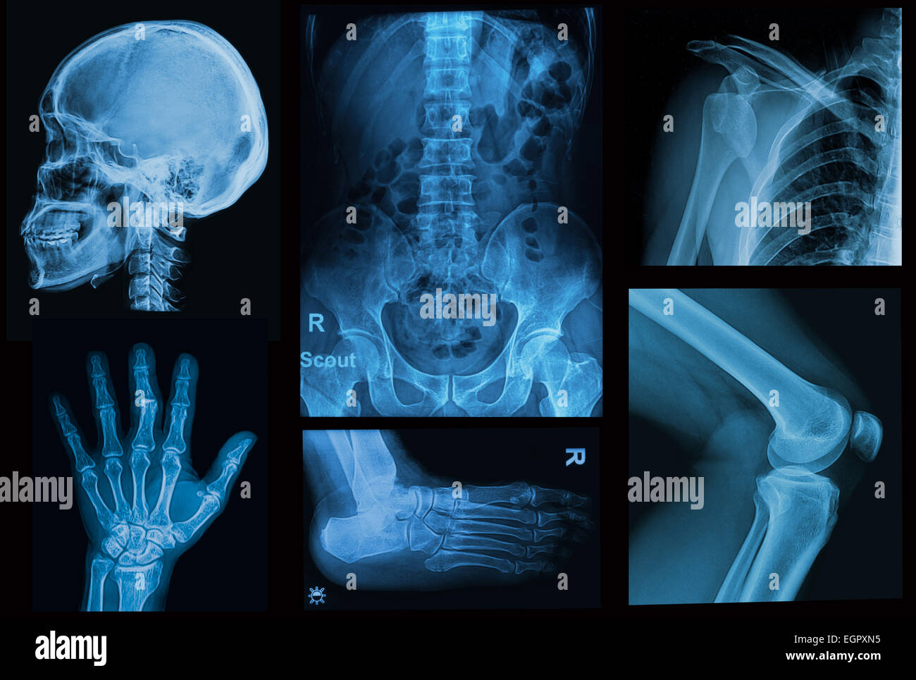 X rays hi-res stock photography and images - Alamy