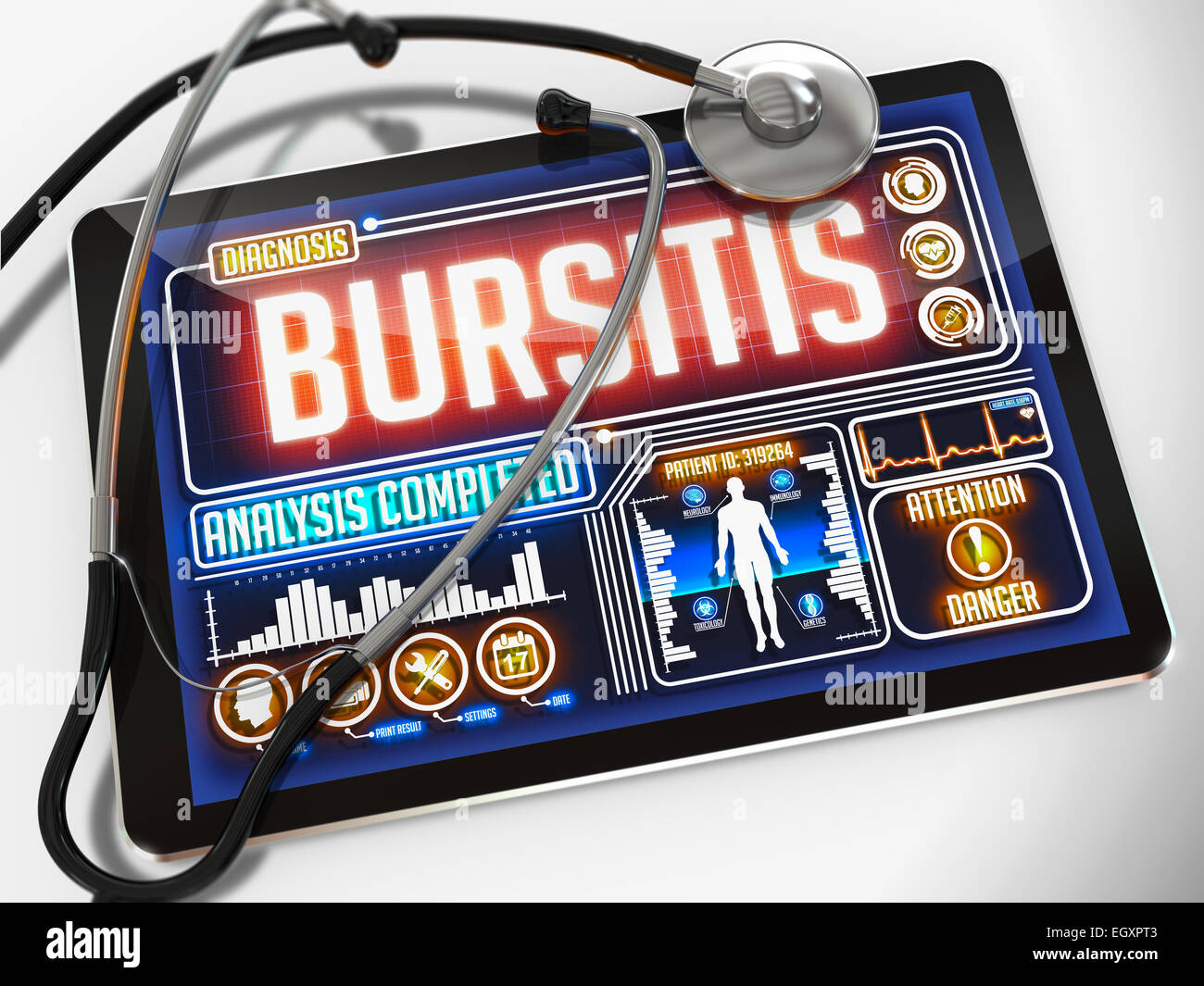 Bursitis hi-res stock photography and images - Alamy