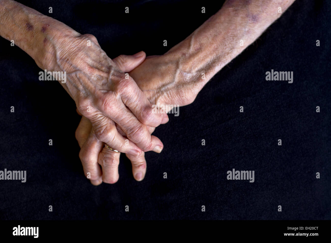 Gnarled hand hi-res stock photography and images - Alamy