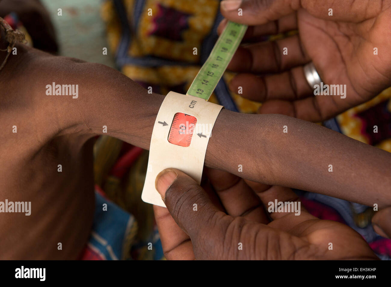 Muac tape hi-res stock photography and images - Alamy