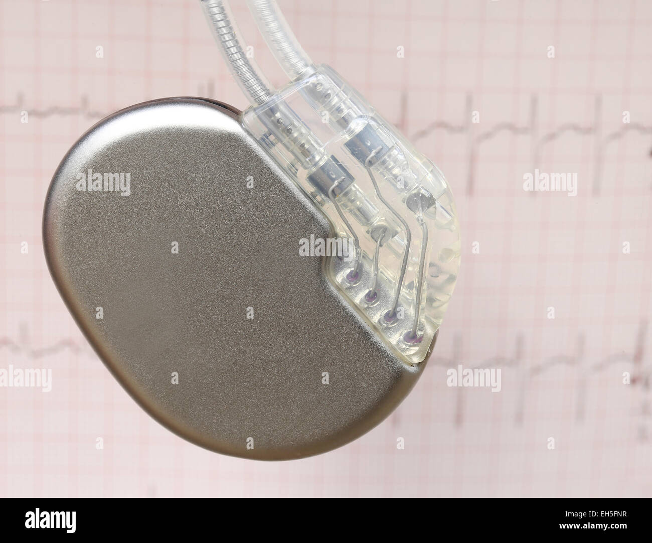 Flutter ecg hi-res stock photography and images - Alamy