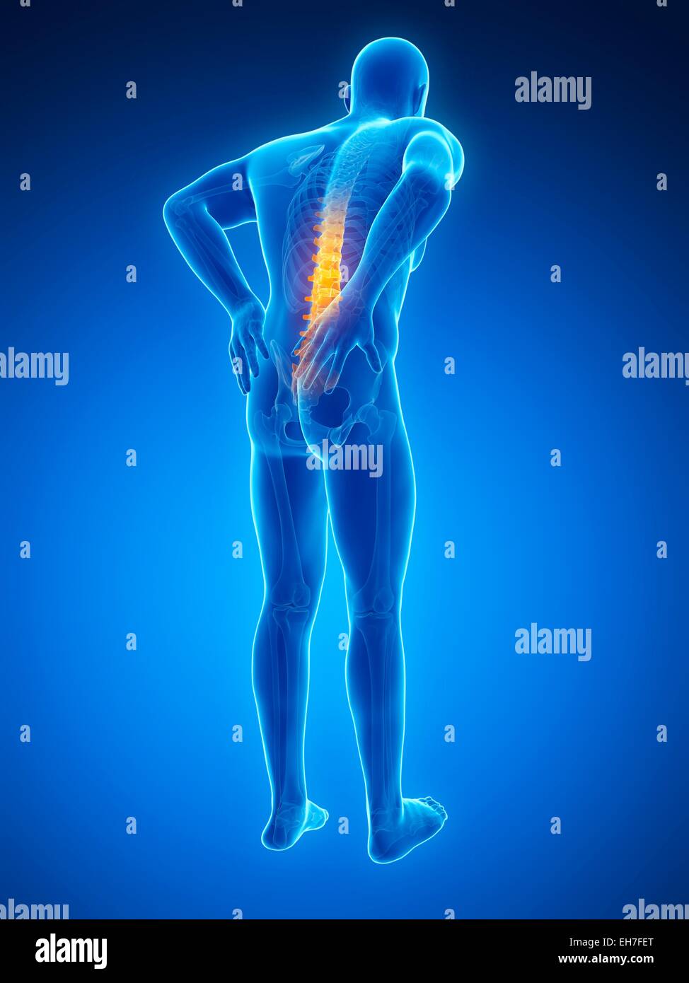 Human back pain, artwork Stock Photo - Alamy