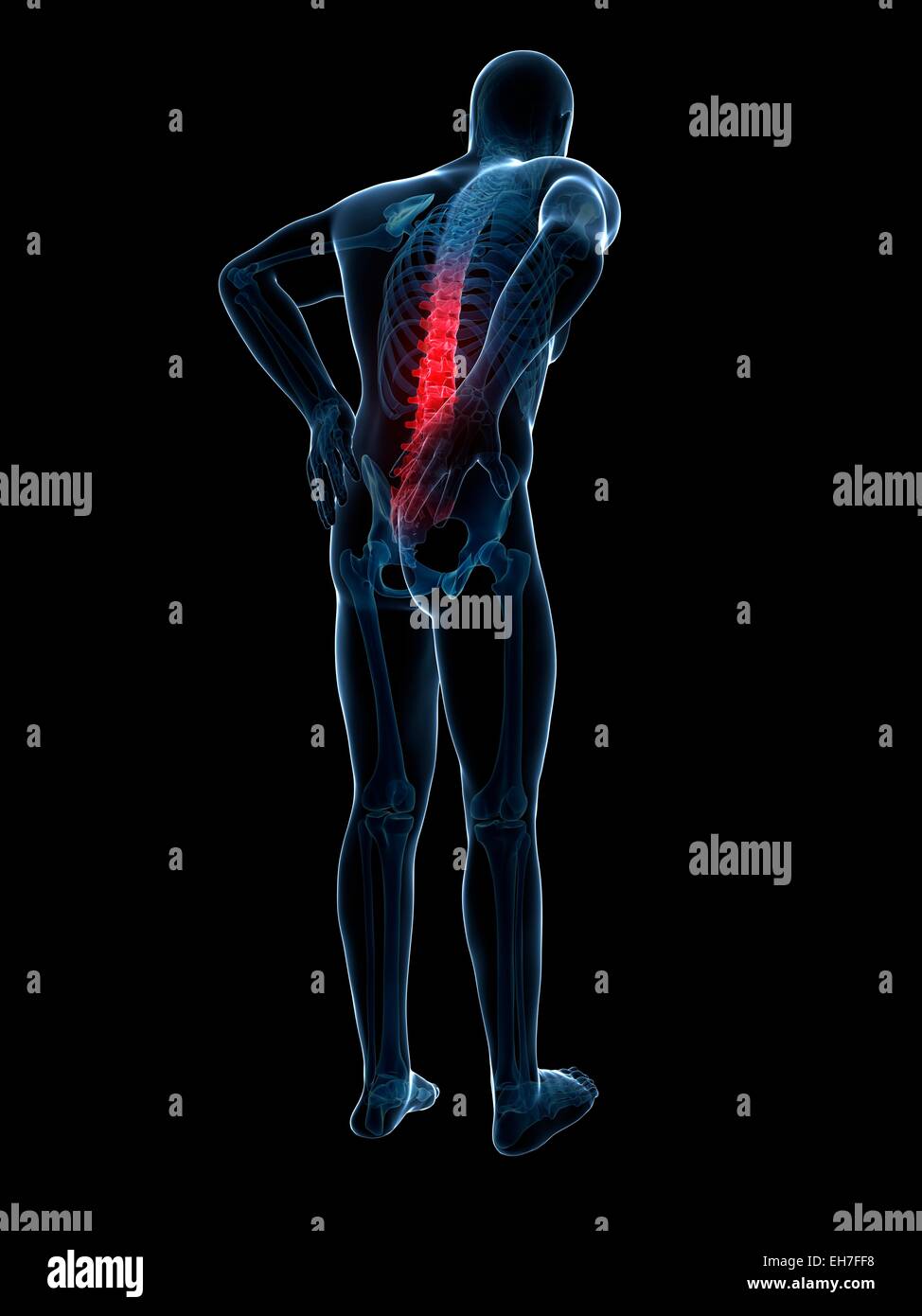 Human back pain, artwork Stock Photo - Alamy