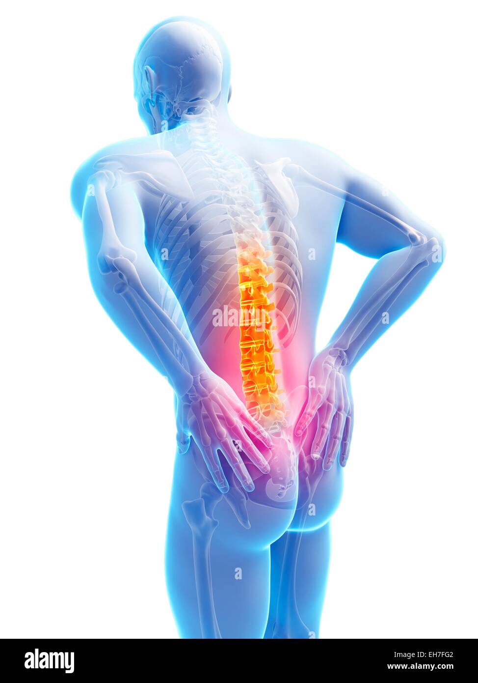 Human back pain, artwork Stock Photo - Alamy