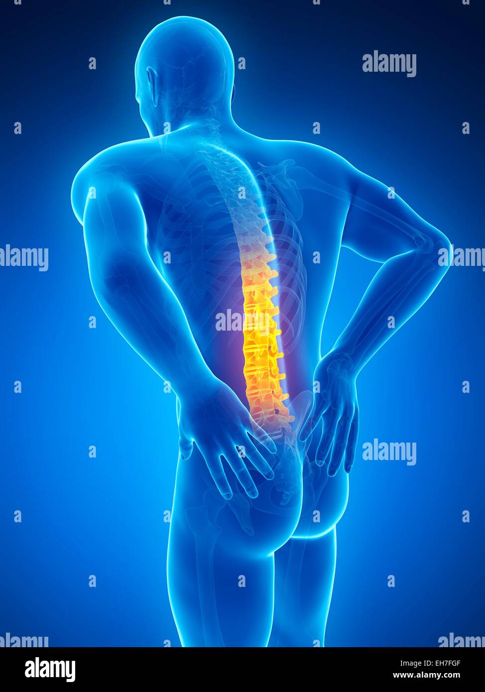 Human back pain, artwork Stock Photo - Alamy