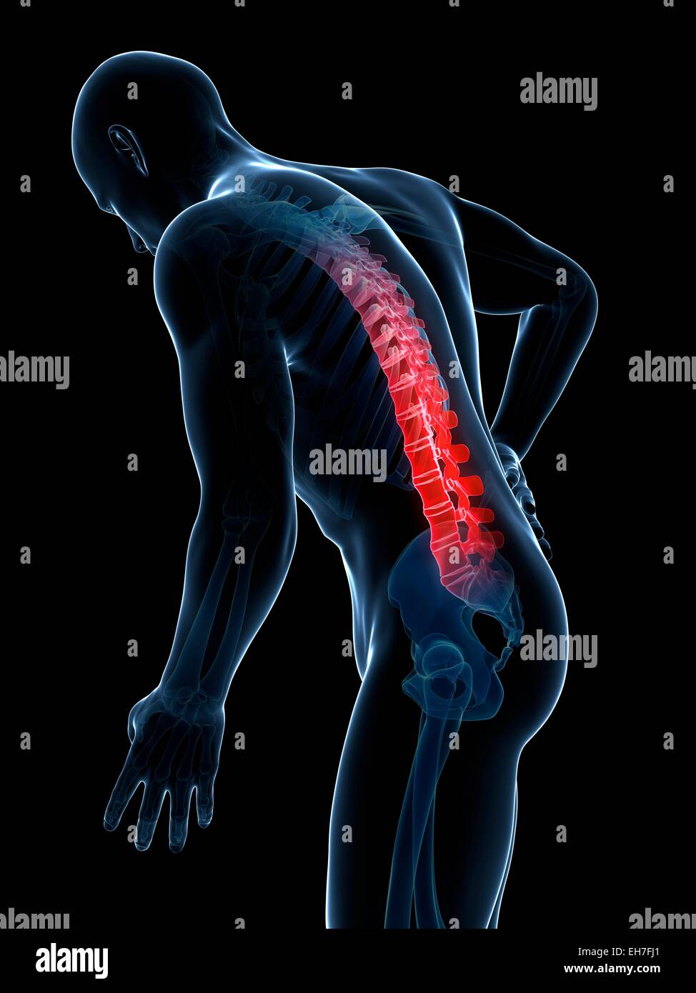 Human back pain, artwork Stock Photo - Alamy