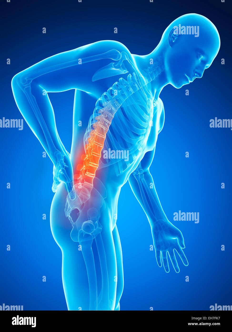Human back pain, artwork Stock Photo - Alamy