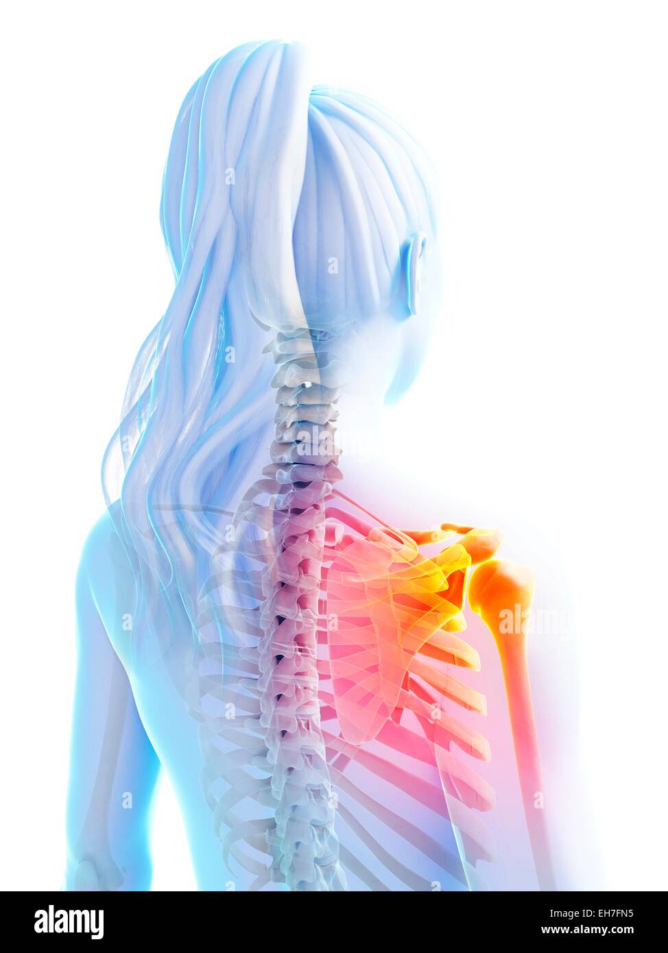 Human shoulder pain hi-res stock photography and images - Alamy