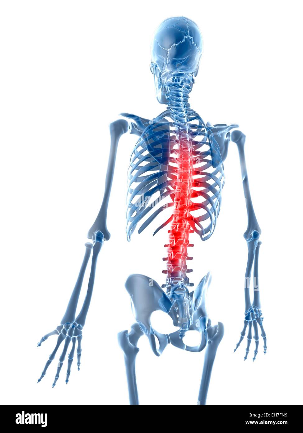 Human back pain, artwork Stock Photo - Alamy