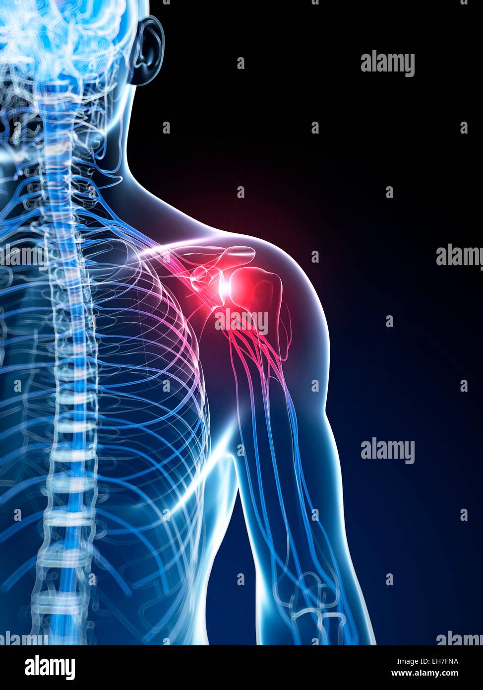 Human shoulder pain, artwork Stock Photo - Alamy