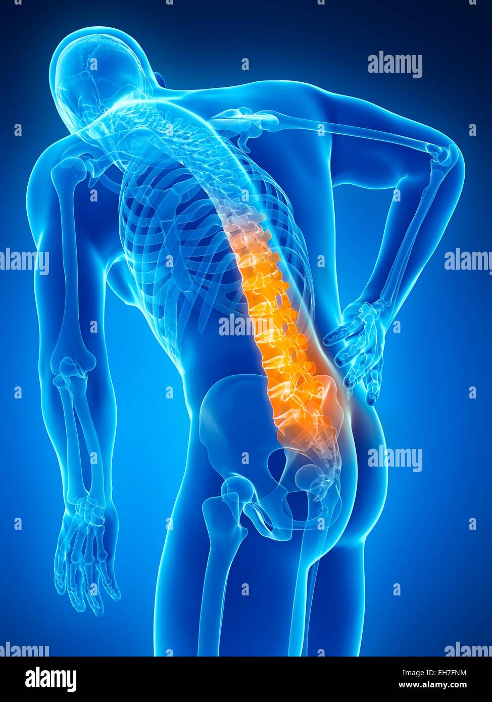 Human back pain, artwork Stock Photo - Alamy