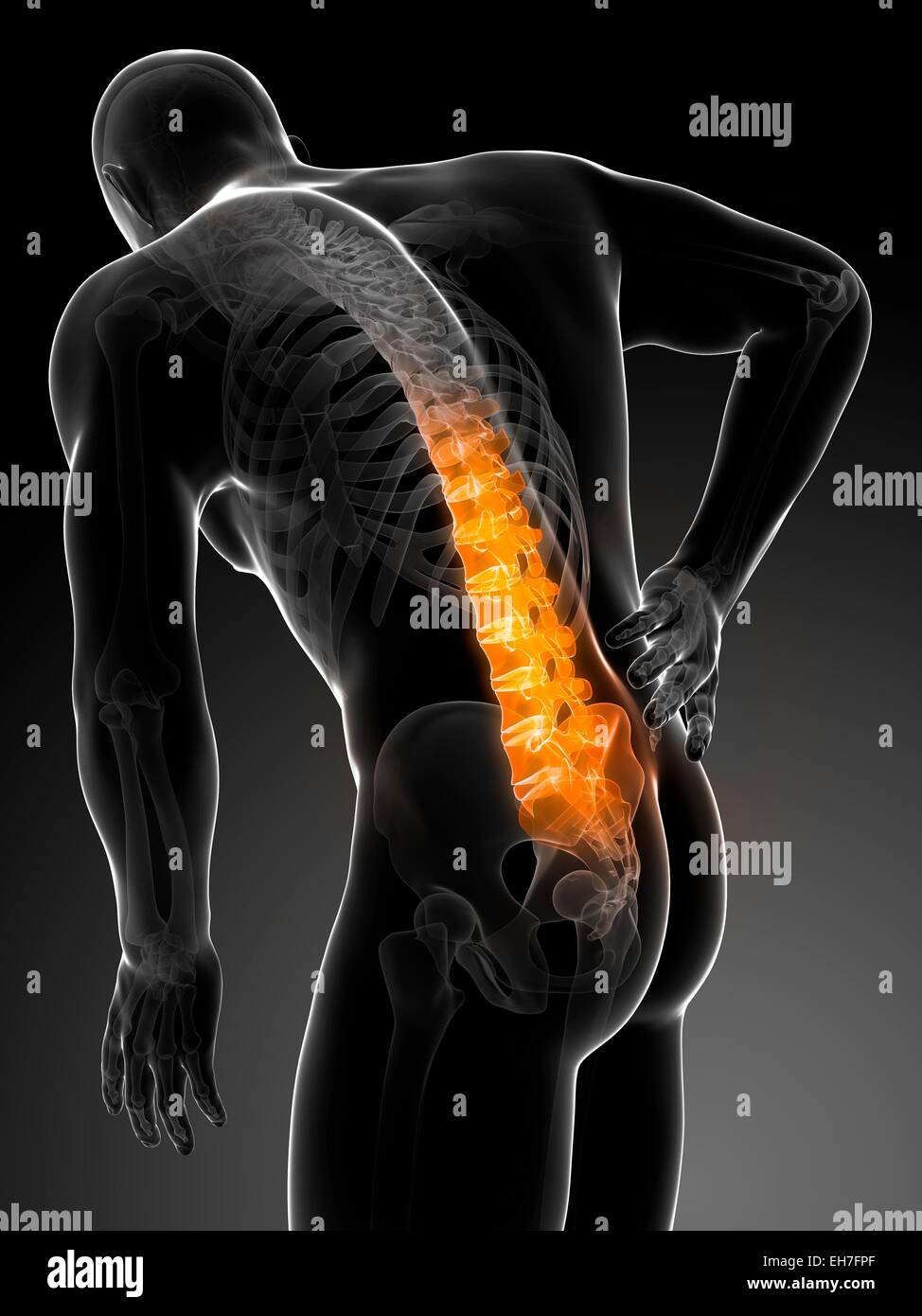 Human back pain, artwork Stock Photo - Alamy