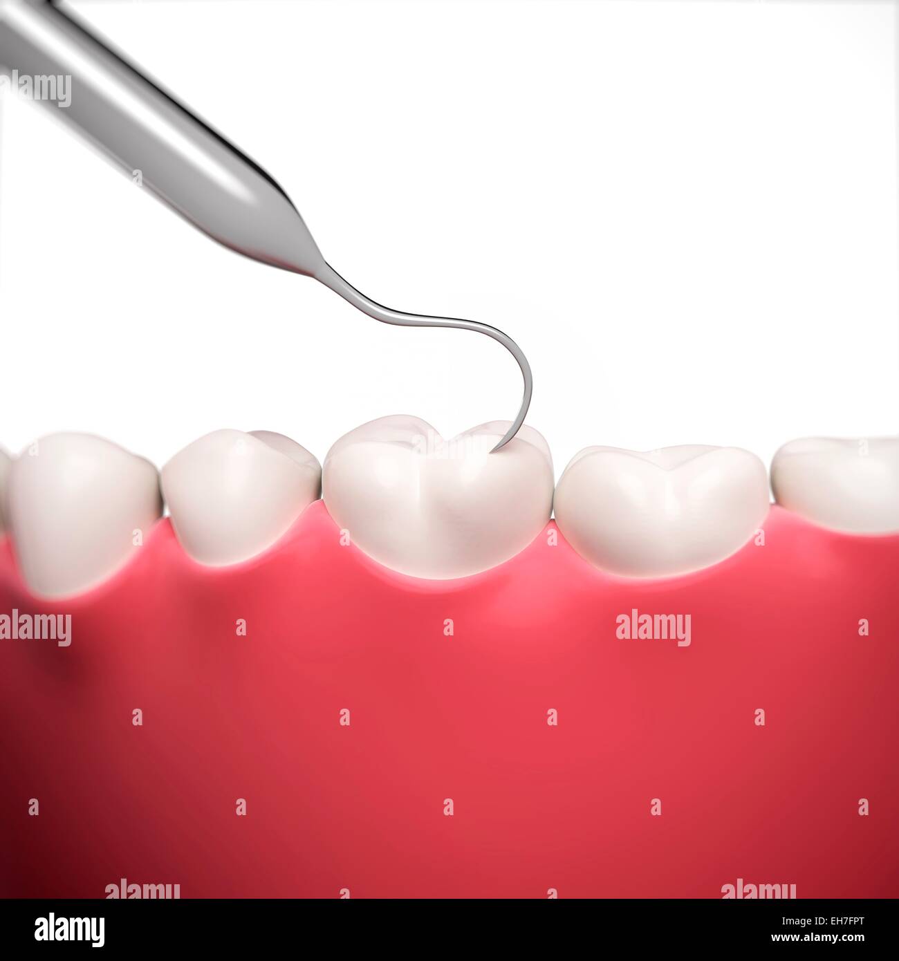 Human teeth being cleaned, artwork Stock Photo - Alamy