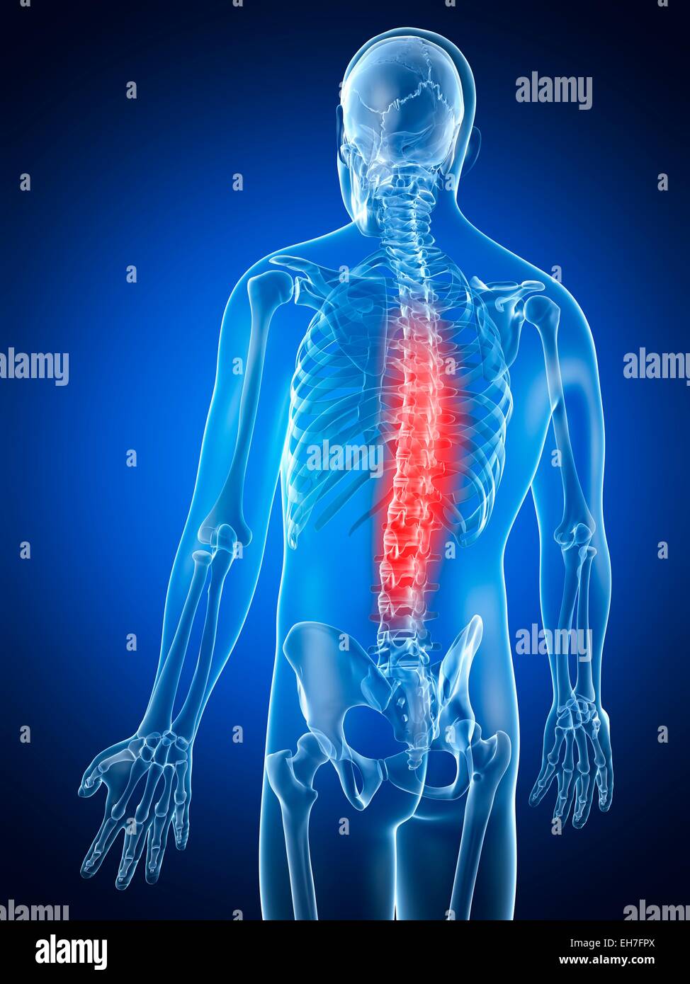 Human back pain, artwork Stock Photo - Alamy