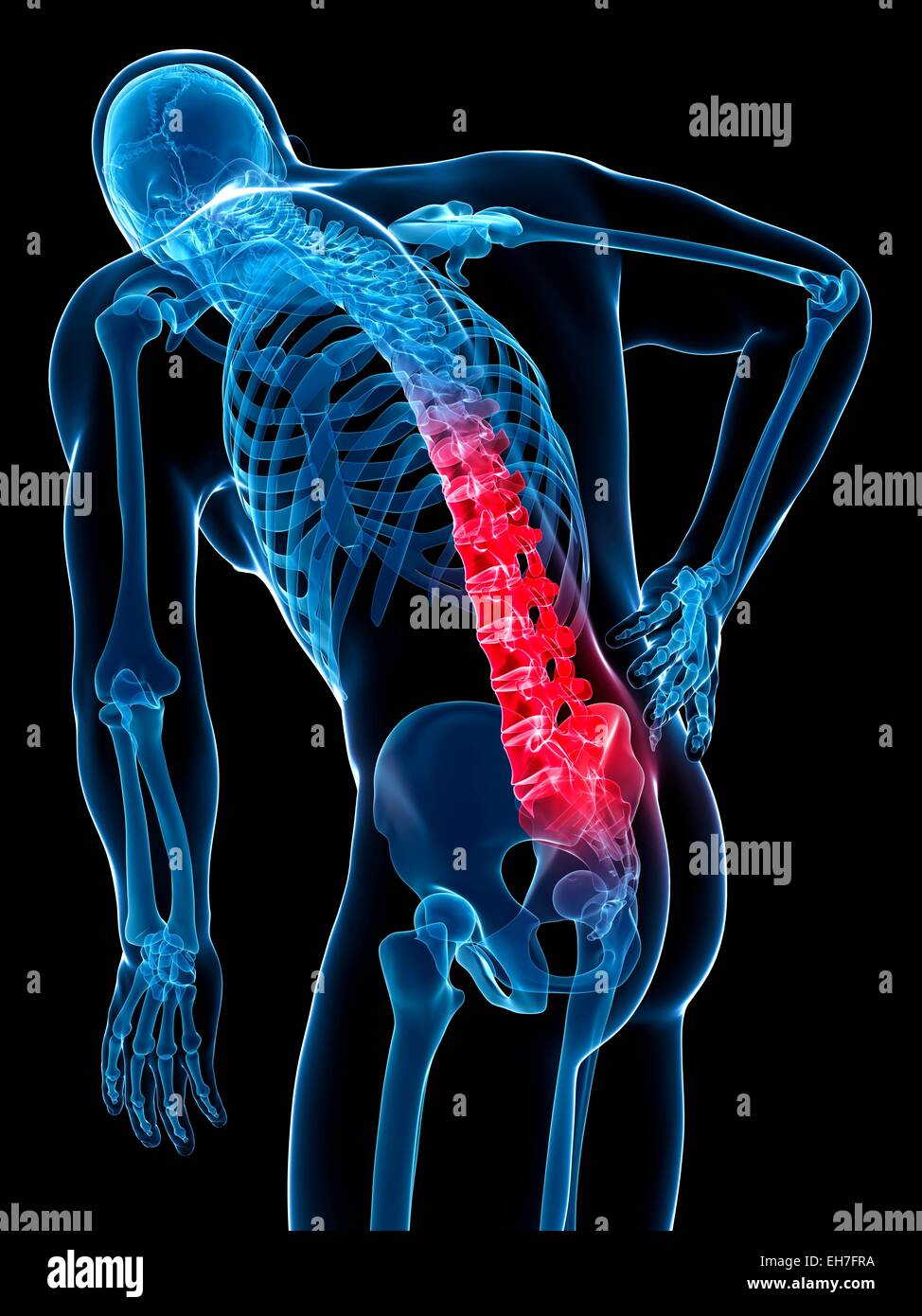 Human back pain, artwork Stock Photo - Alamy