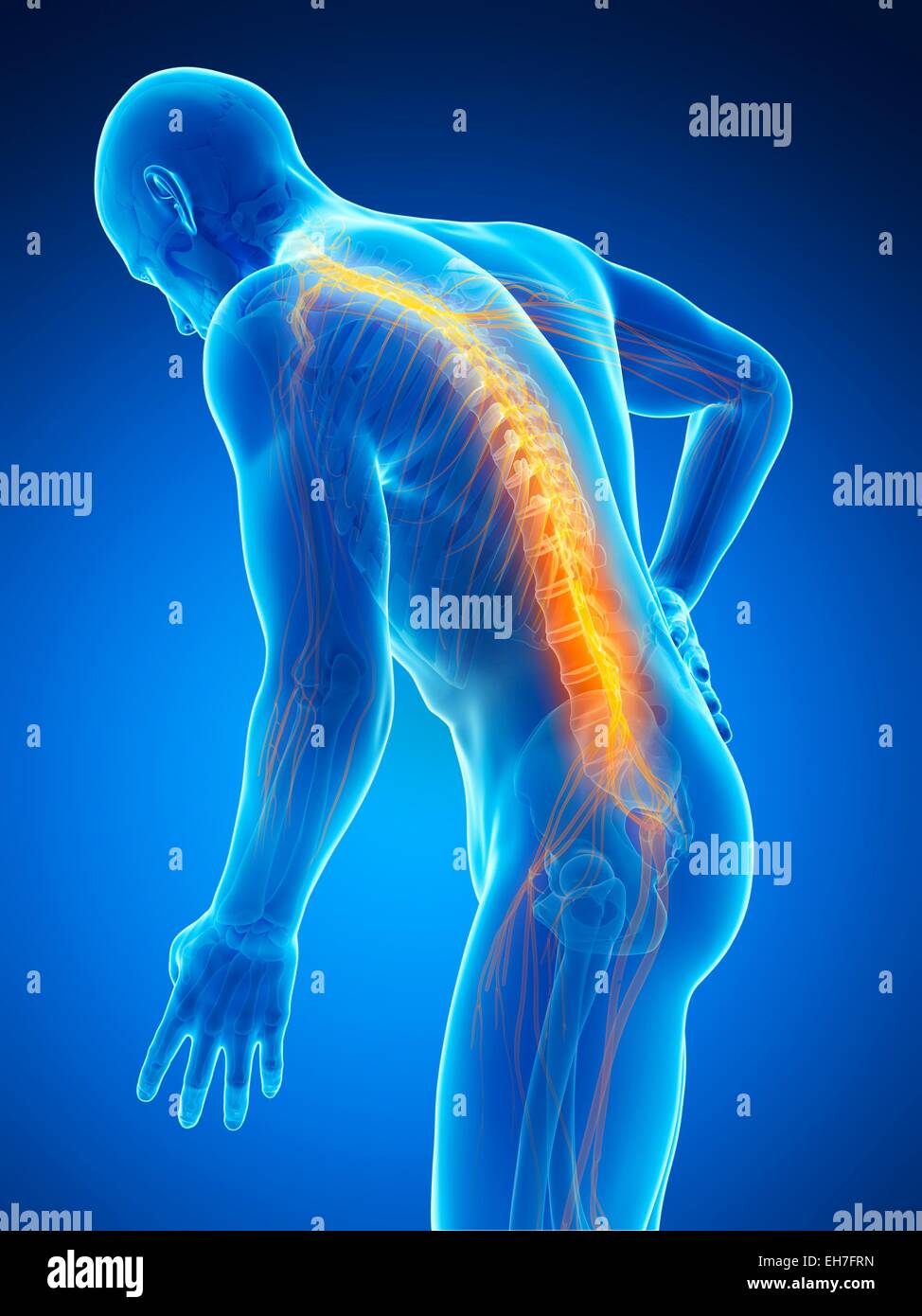 Human back pain, artwork Stock Photo - Alamy