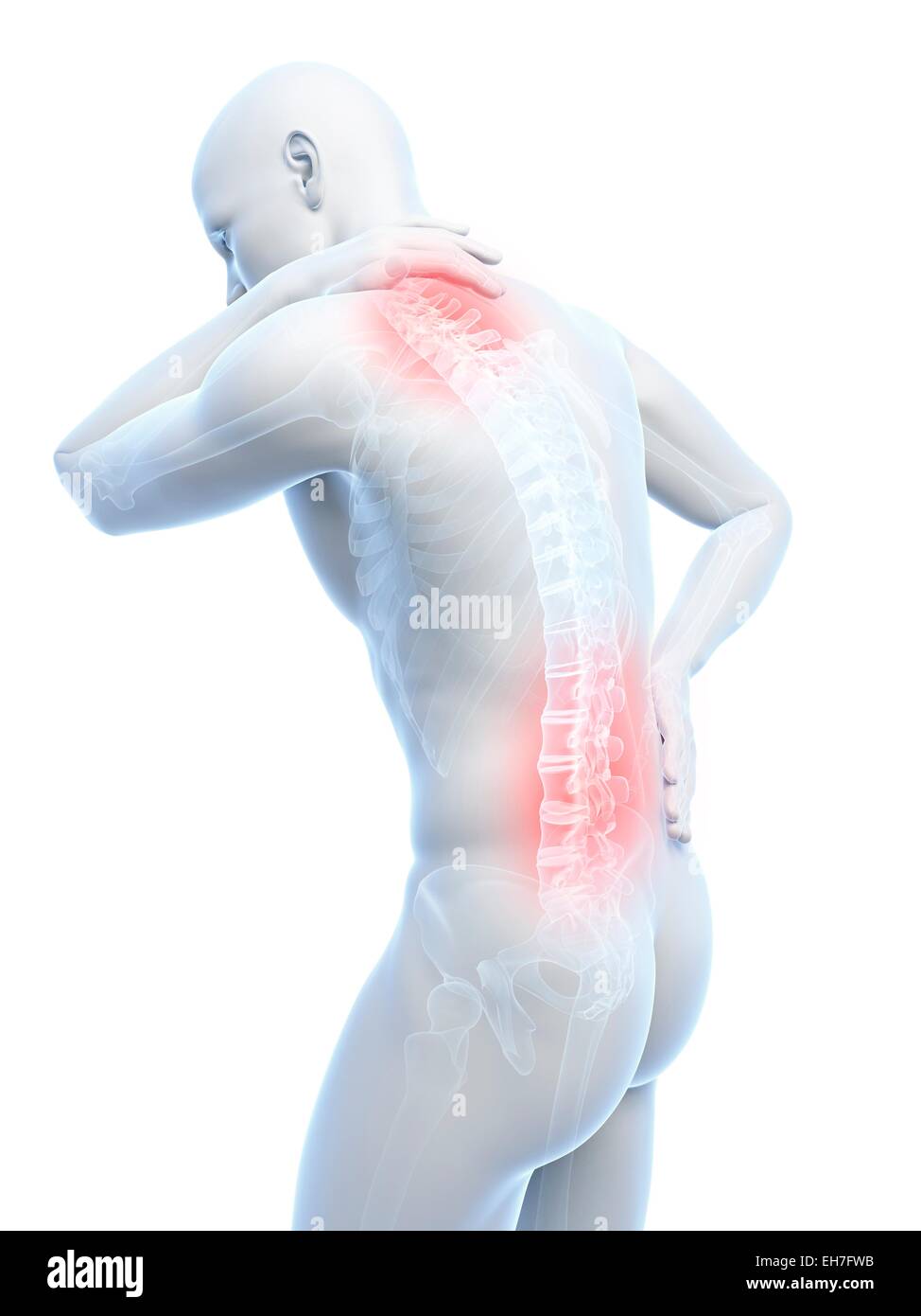 Lower Back Pain Illustration Stock Photos & Lower Back Pain ...