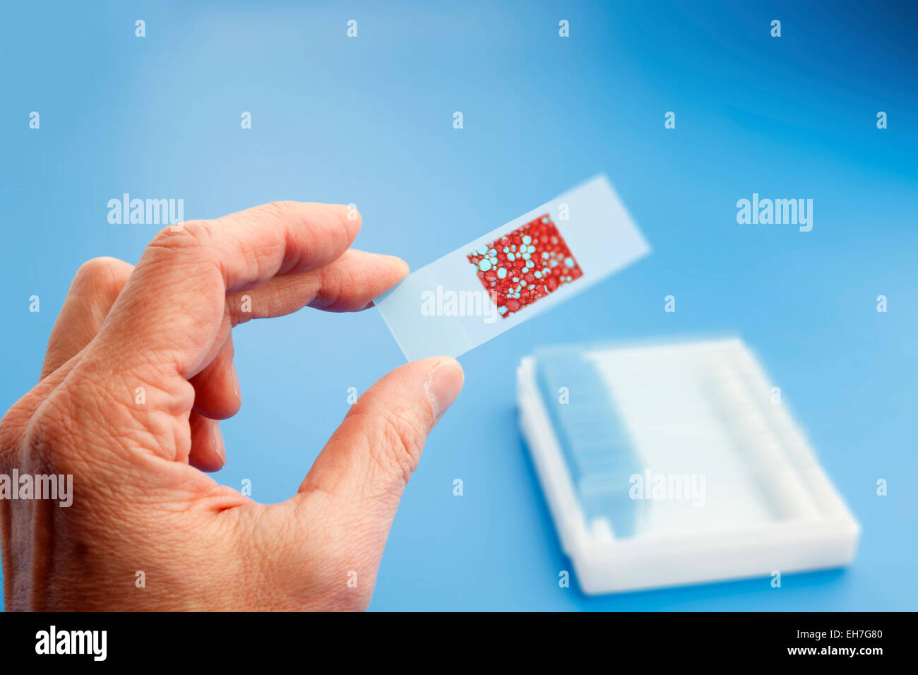 Microscope slide blue sample blood sample hi-res stock photography and ...