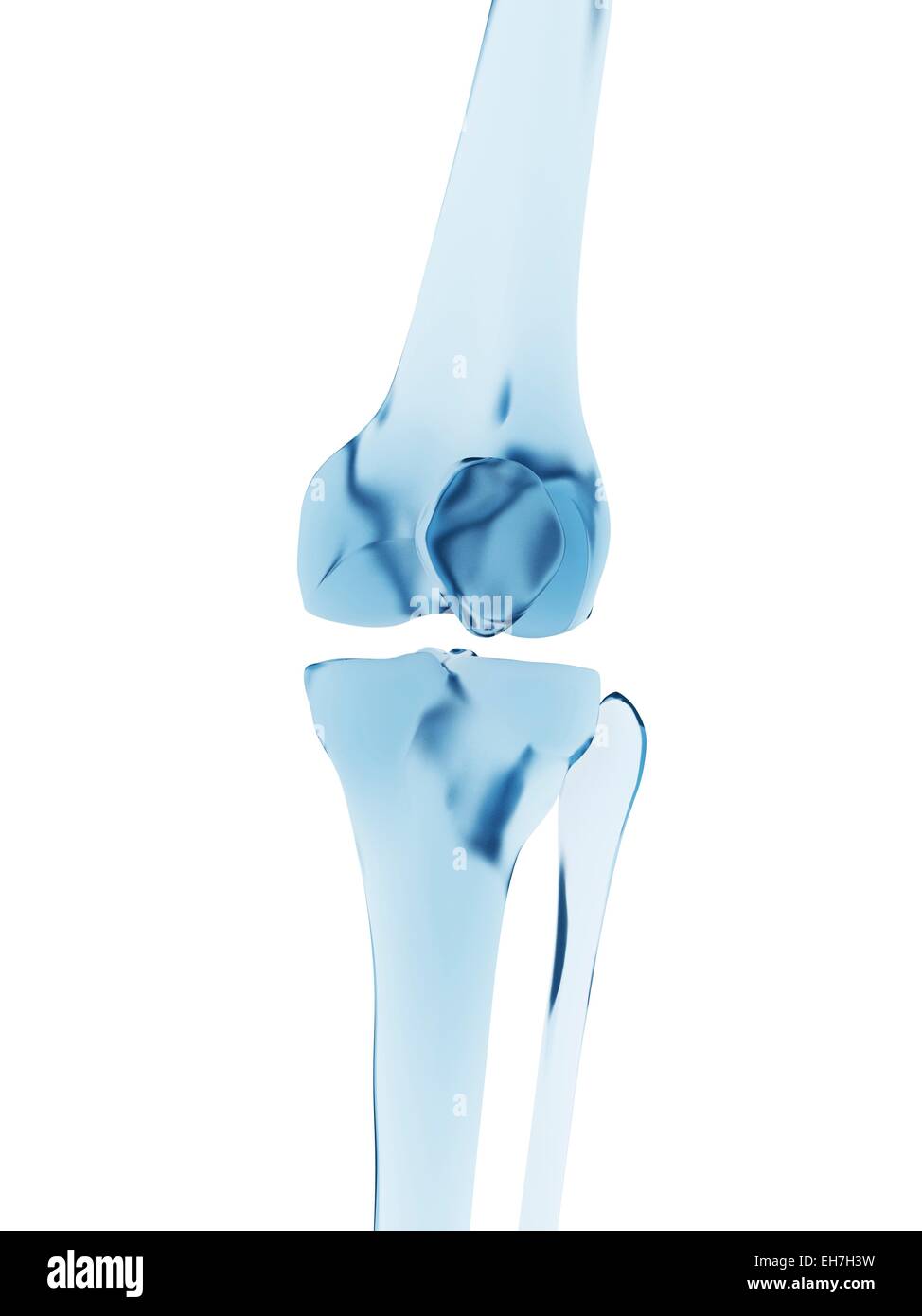 Human knee bones, illustration Stock Photo - Alamy