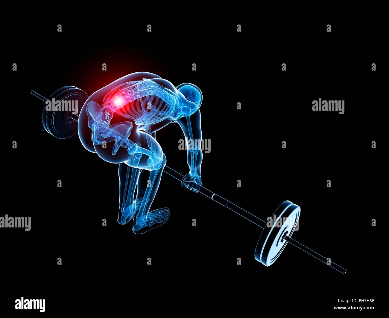 Incorrect lifting posture hi-res stock photography and images - Alamy
