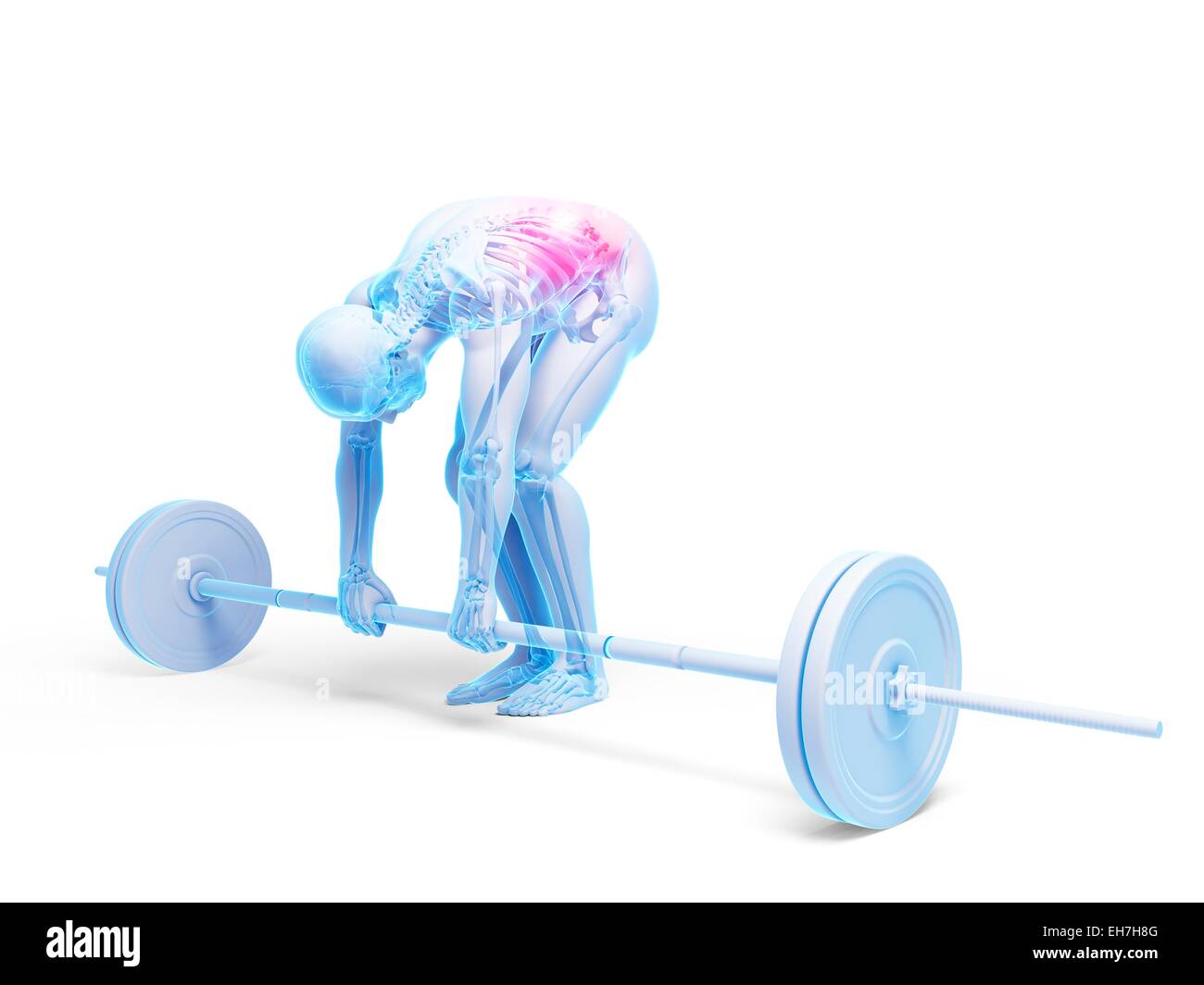 Incorrect lifting posture hi-res stock photography and images - Alamy