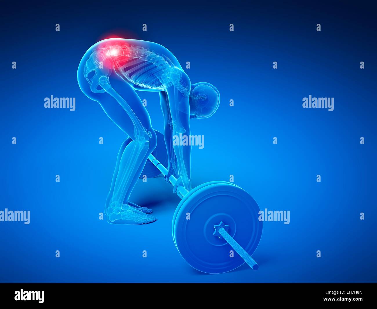 Incorrect lifting posture hi-res stock photography and images - Alamy