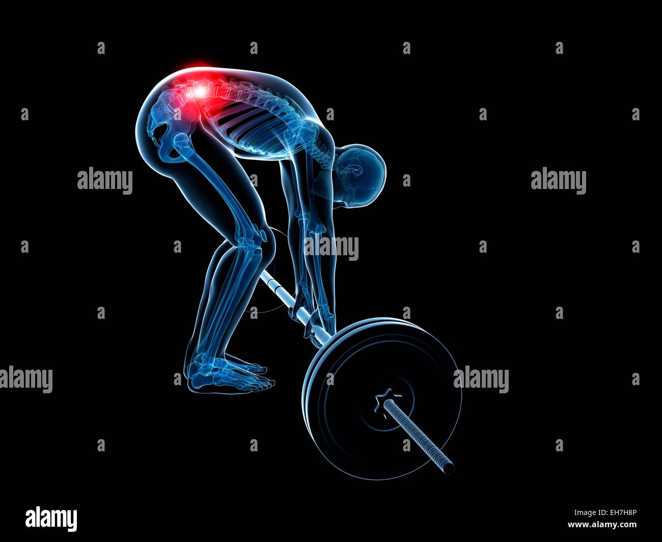 Weight lifting, incorrect posture Stock Photo - Alamy