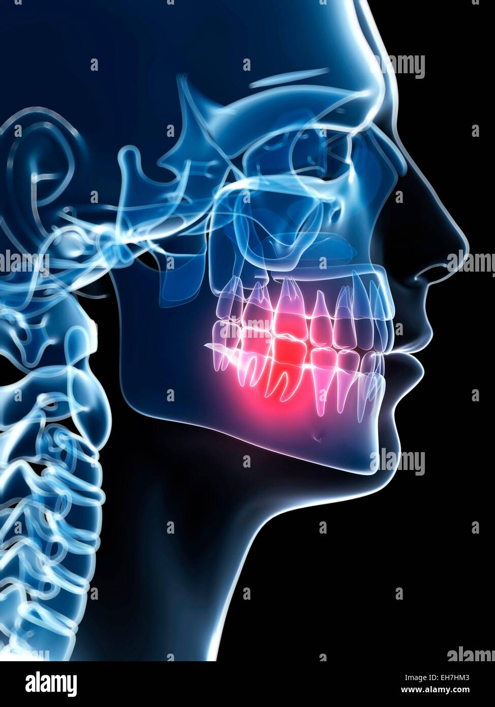 Human tooth pain, illustration Stock Photo - Alamy