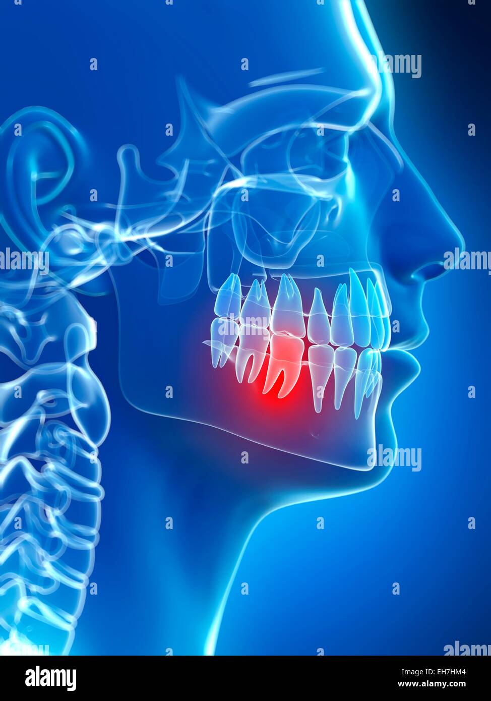 Human tooth pain, illustration Stock Photo - Alamy