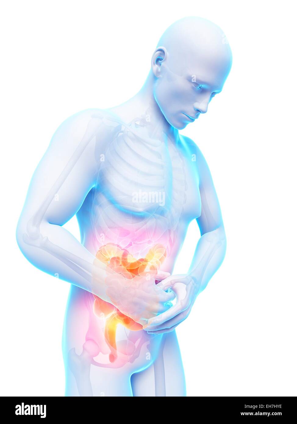 Abnormal large intestine hi-res stock photography and images - Alamy