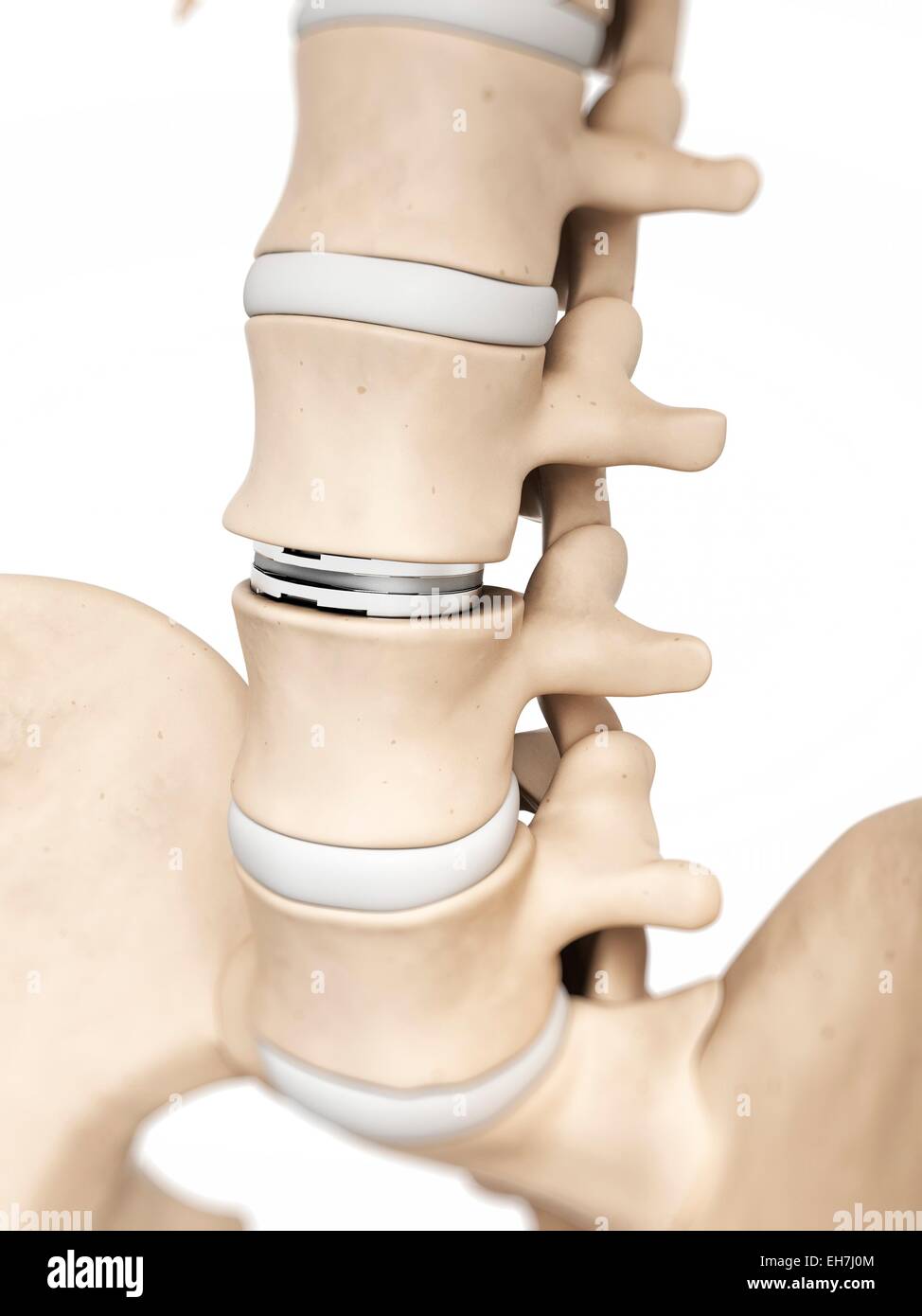 Human lumber spine hi-res stock photography and images - Alamy