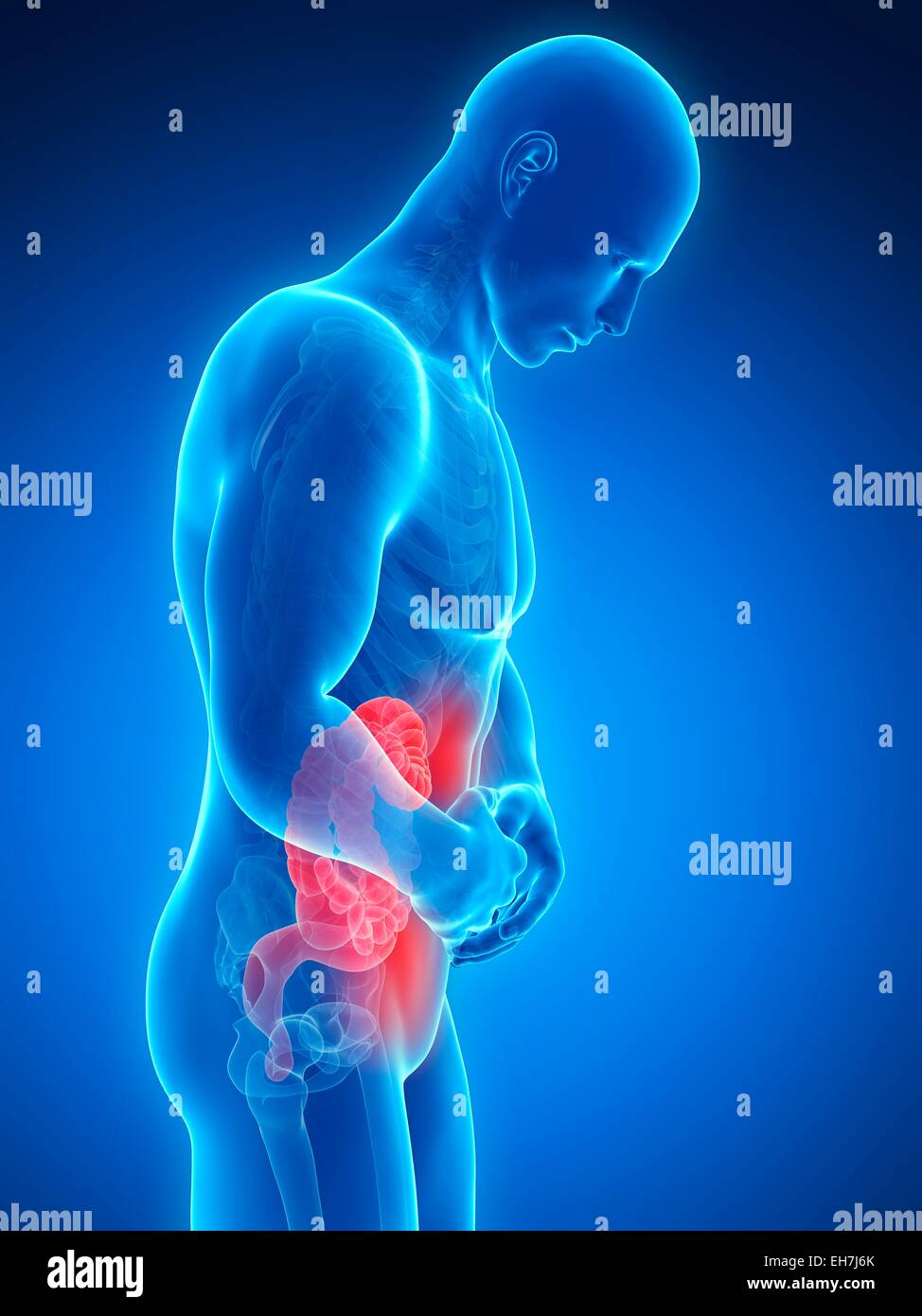 Intestine pain hi-res stock photography and images - Alamy