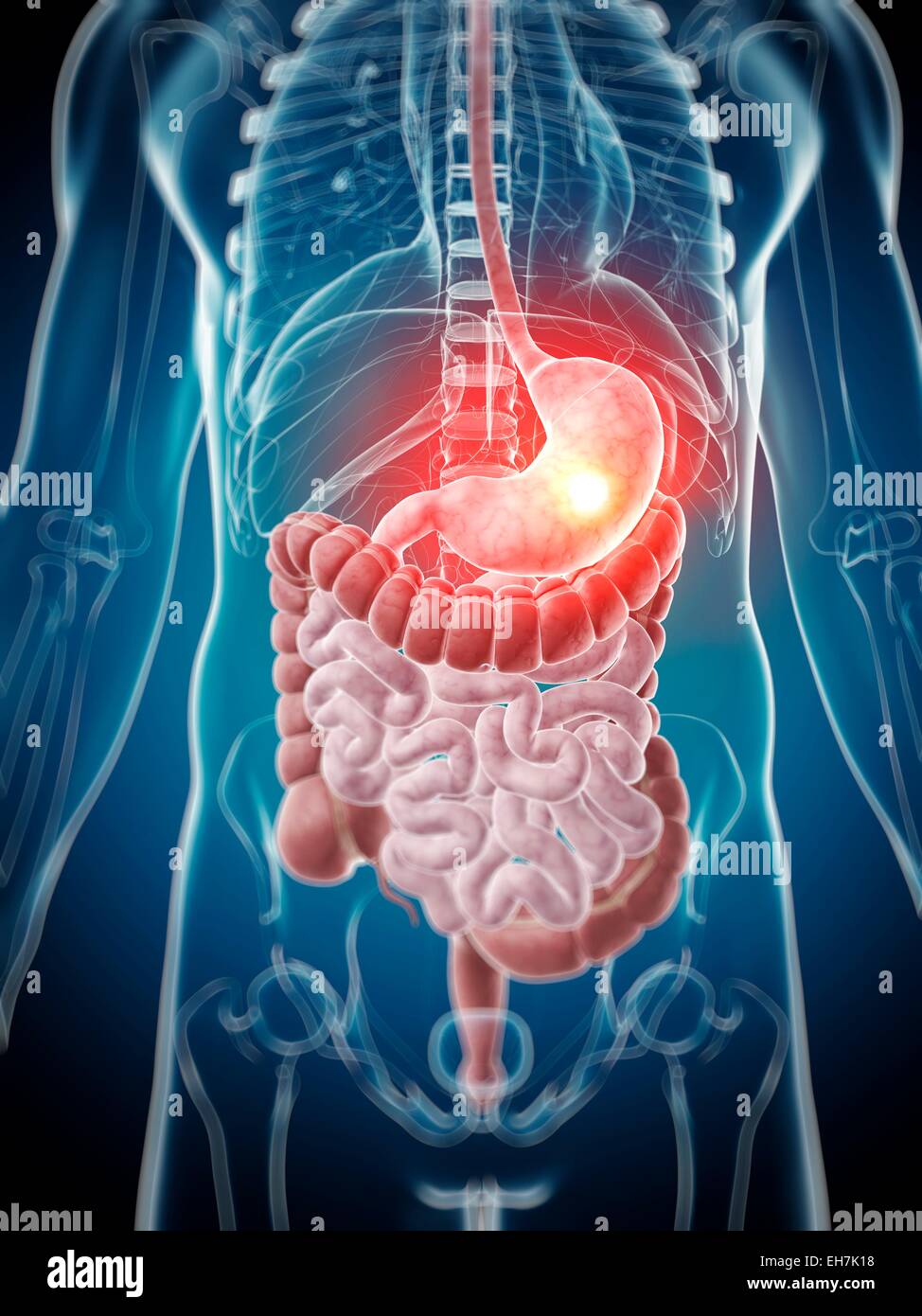 Human stomach pain, illustration Stock Photo - Alamy