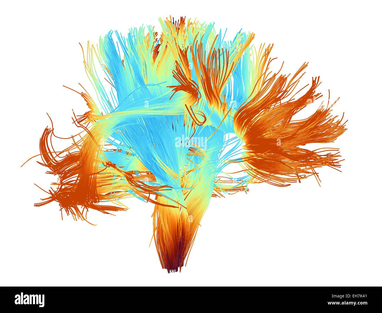 White matter fibres of the human brain Stock Photo - Alamy