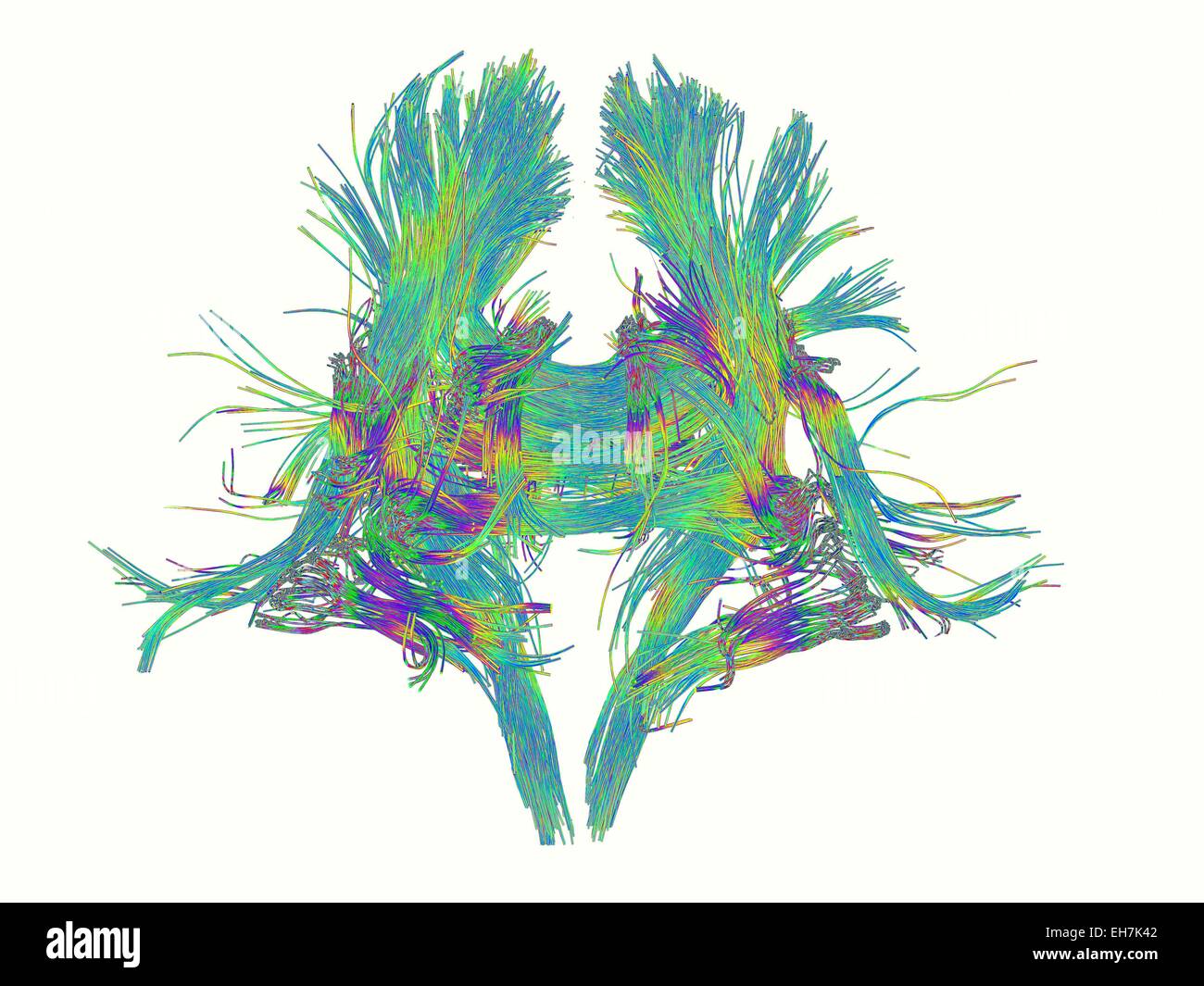 Brain mapping hi-res stock photography and images - Alamy