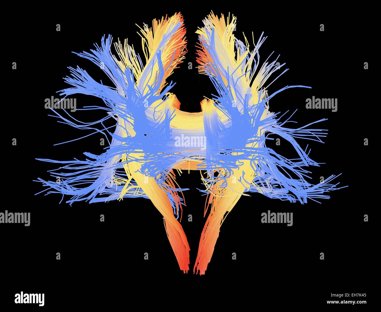 White matter fibres of the human brain Stock Photo - Alamy