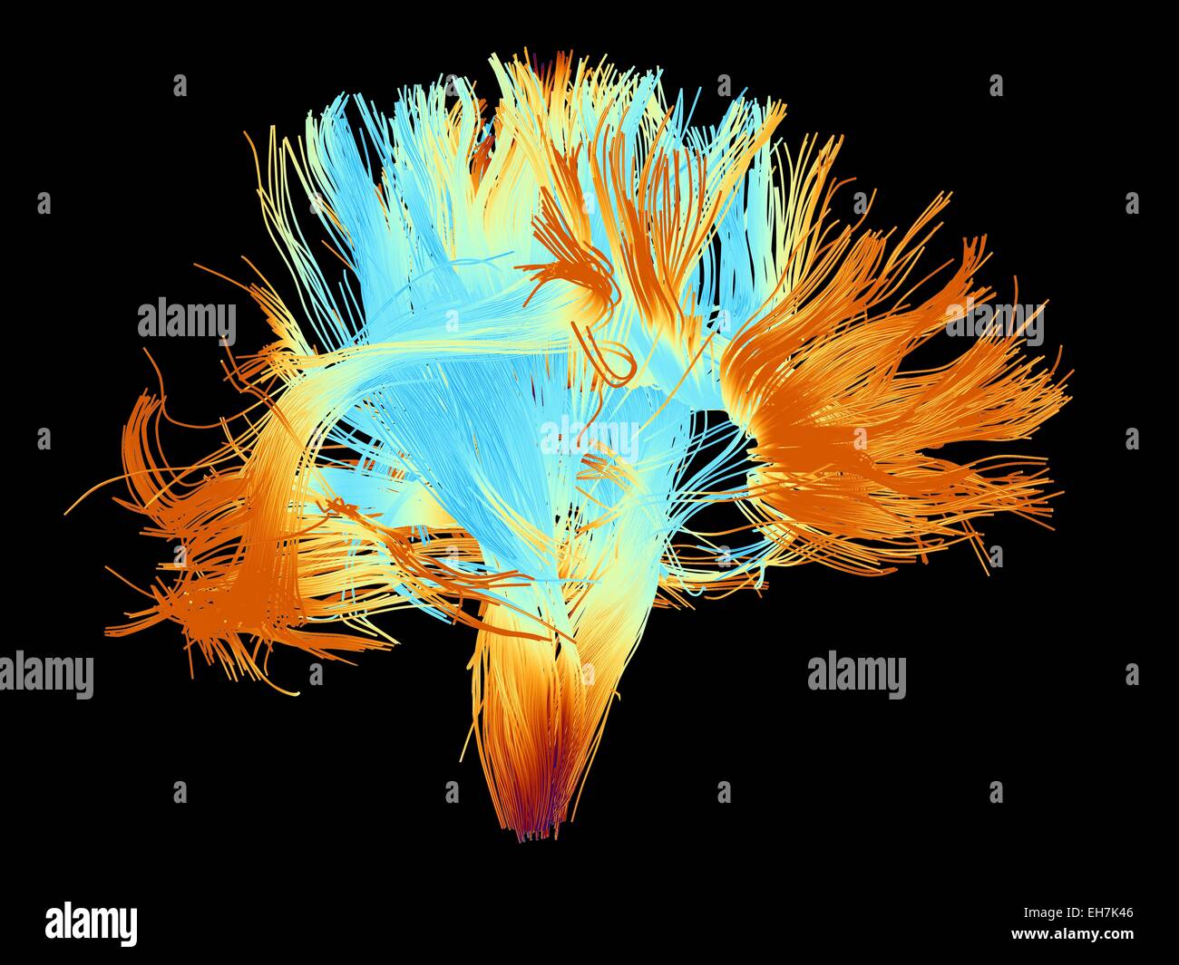White matter fibres of the human brain Stock Photo - Alamy
