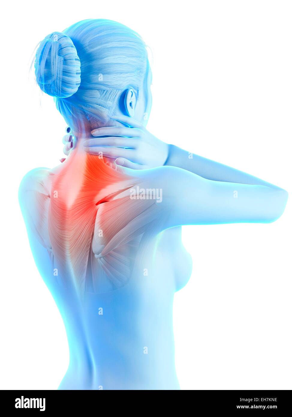 Human neck pain, illustration Stock Photo - Alamy
